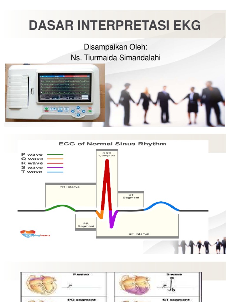 Dasar Interpretasi Ekg | PDF
