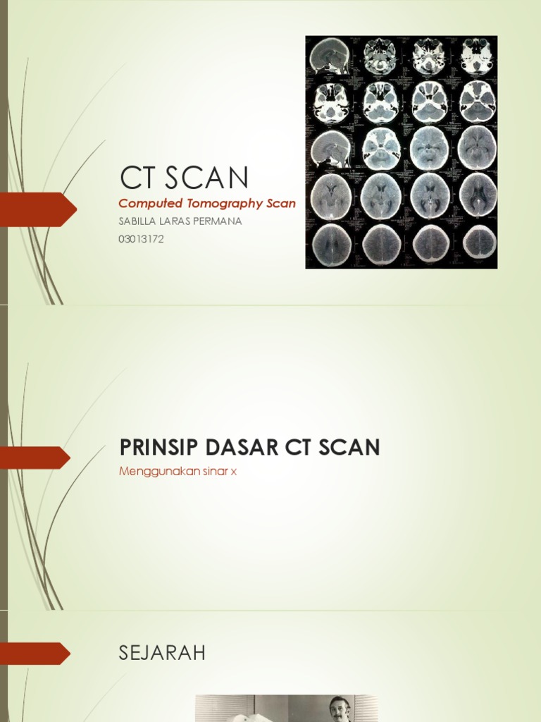 CT Scan | PDF