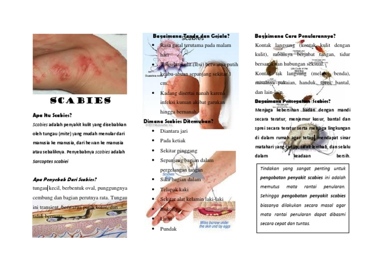 Leaflet Scabies | PDF