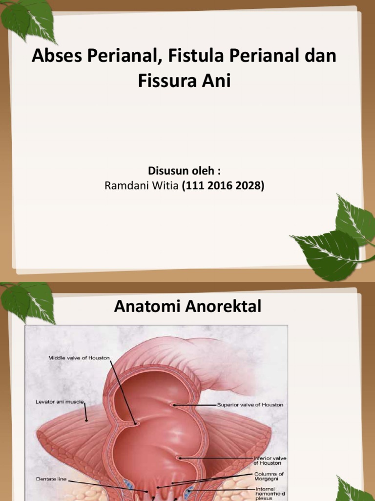 Abses Perianal, Fistula, Dan Fissura Ani | PDF