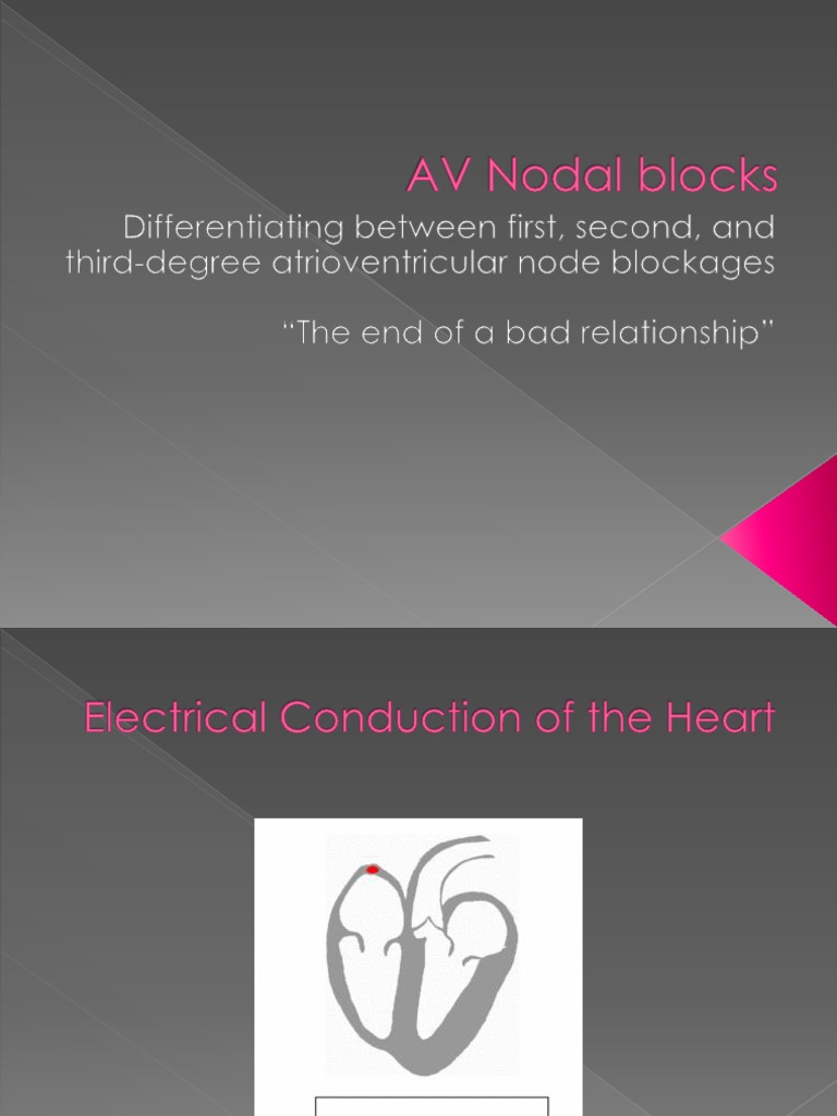 AV Nodal Blocks | PDF