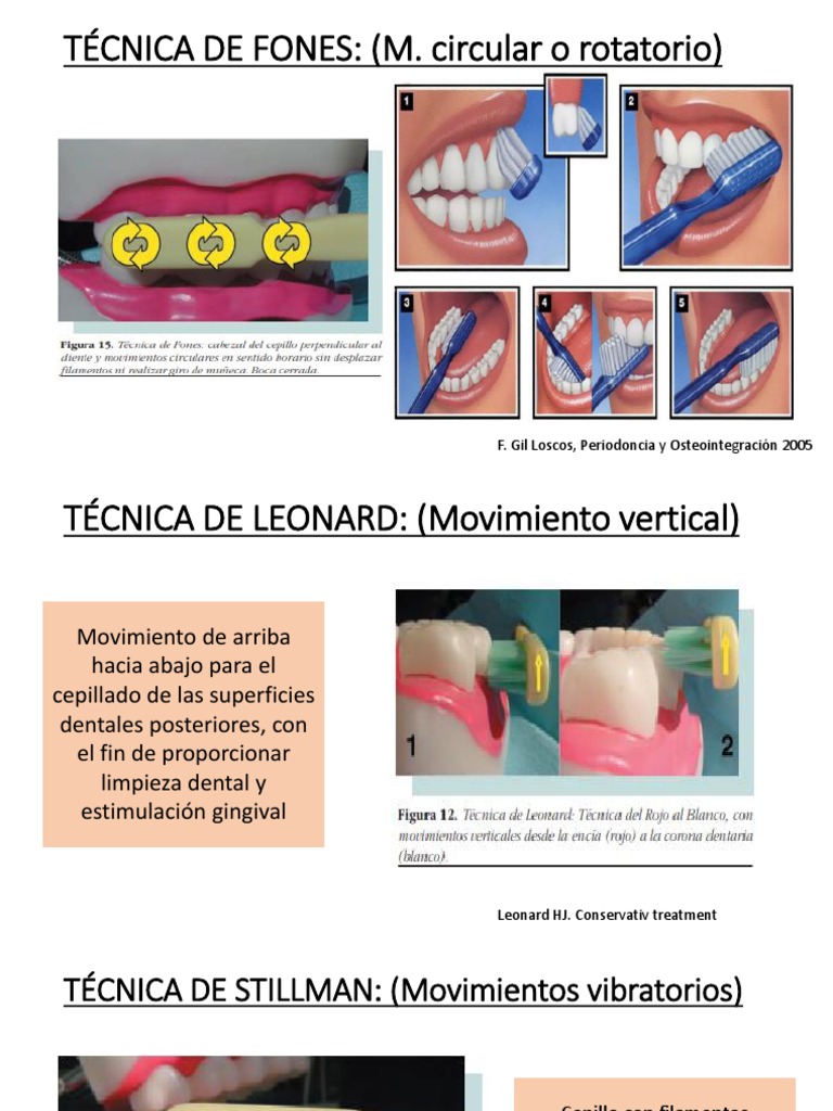 Técnicas de Cepillado Dental Fones y Leonard | PDF | Ramas de ...