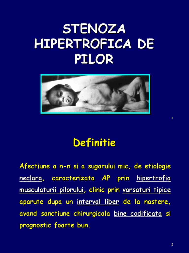 2.2. Curs Stenoza Hipertrofica de Pilor | PDF