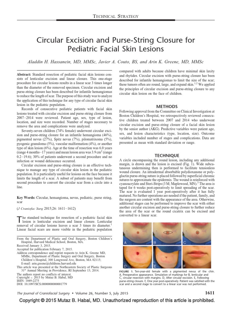 Circular Excision | PDF | Surgery | Scar