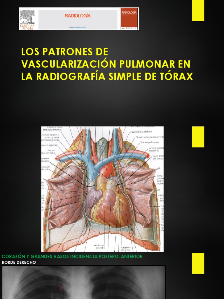 Patrones Vasculares RX Torax | PDF