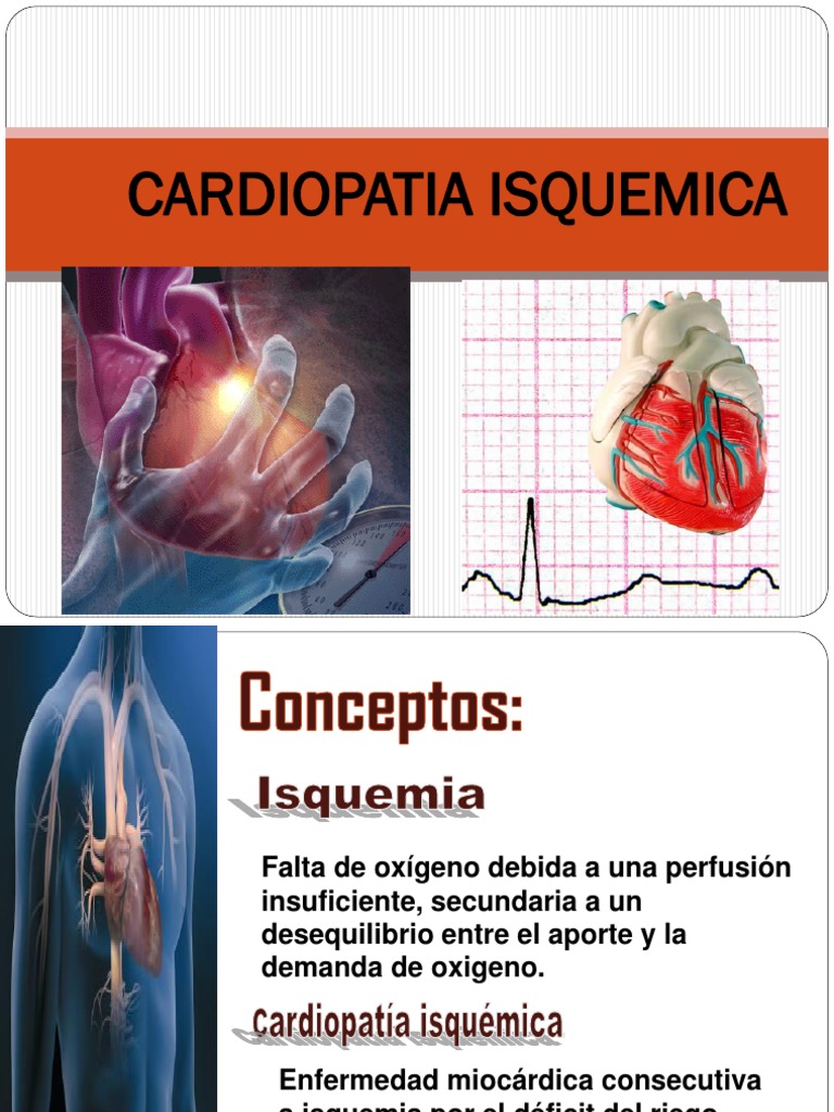 Cardiopatia Isquemica | PDF | Infarto de miocardio | Isquemia