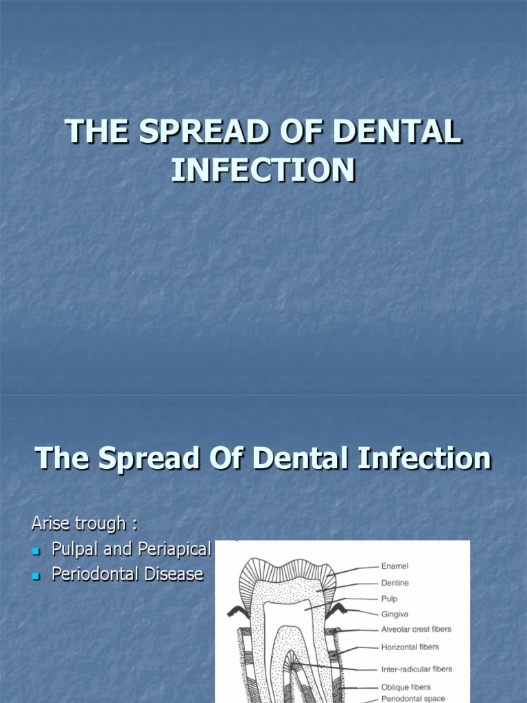 The Spread of Dental Infection | PDF | Inflammation | Dentistry