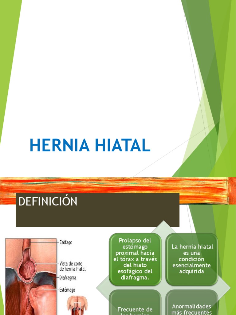 Presentacion Hernia Hiatal | PDF | Enfermedades y trastornos | Medicina CLINICA