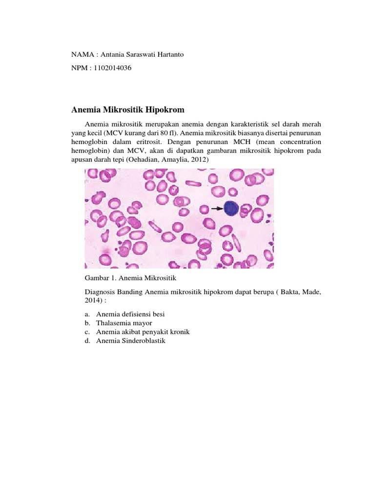 DDAnemia Mikrositik Hipokrom | PDF