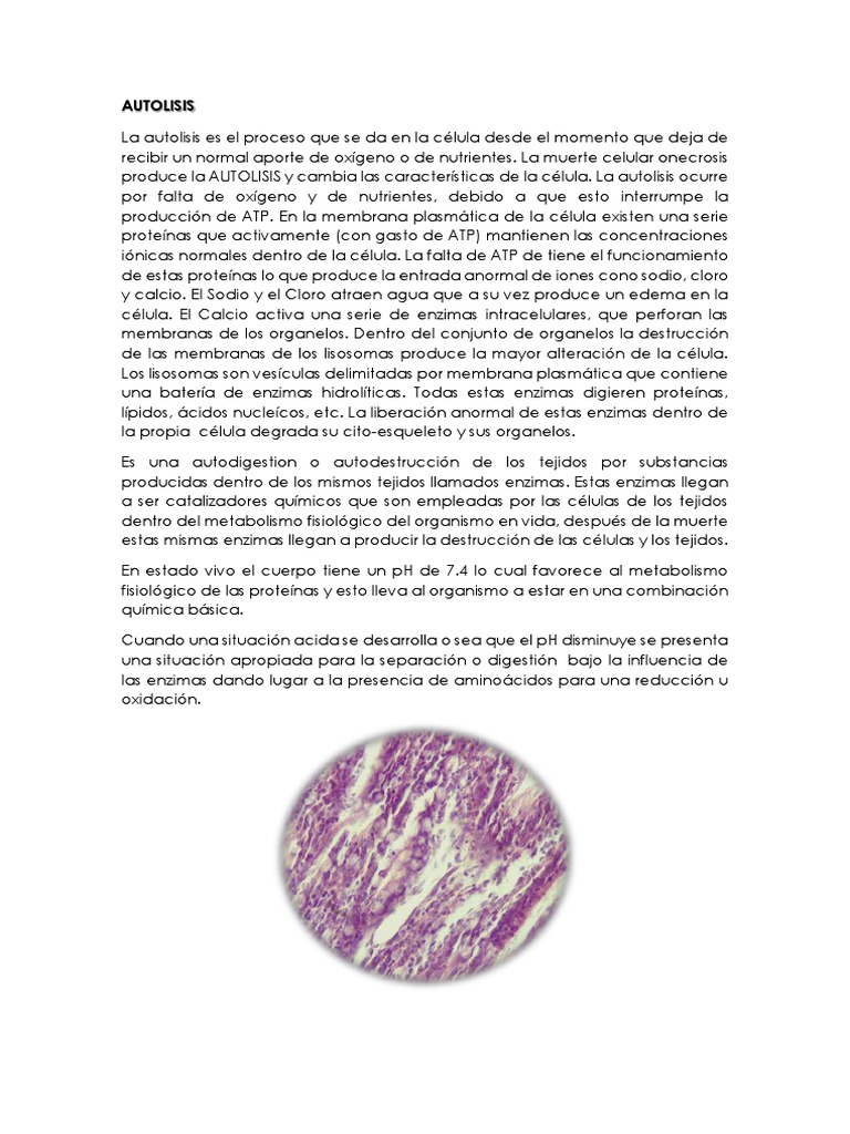 Definición y Proceso de Autolisis | PDF | Biología Celular) | Membrana ...