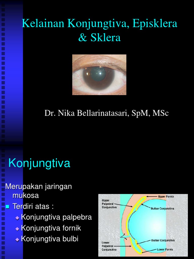 Kelainan Konjungtiva, Episklera - Sklera - Dr. Bella | PDF