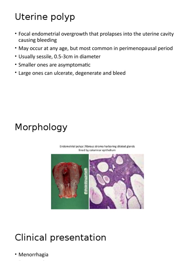 Uterine Polyp | PDF | Sexual Anatomy | Female Mammals