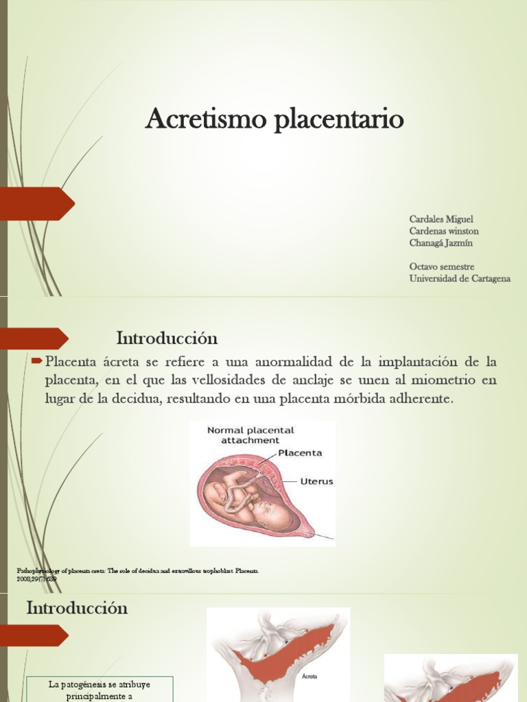 acretismo Placentario | Placenta | Parto | Prueba gratuita de 30 días ...