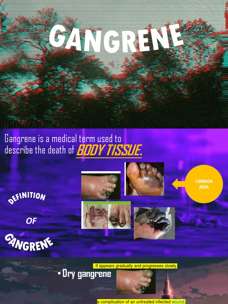 Gangrene | PDF | Wound | Medical Specialties