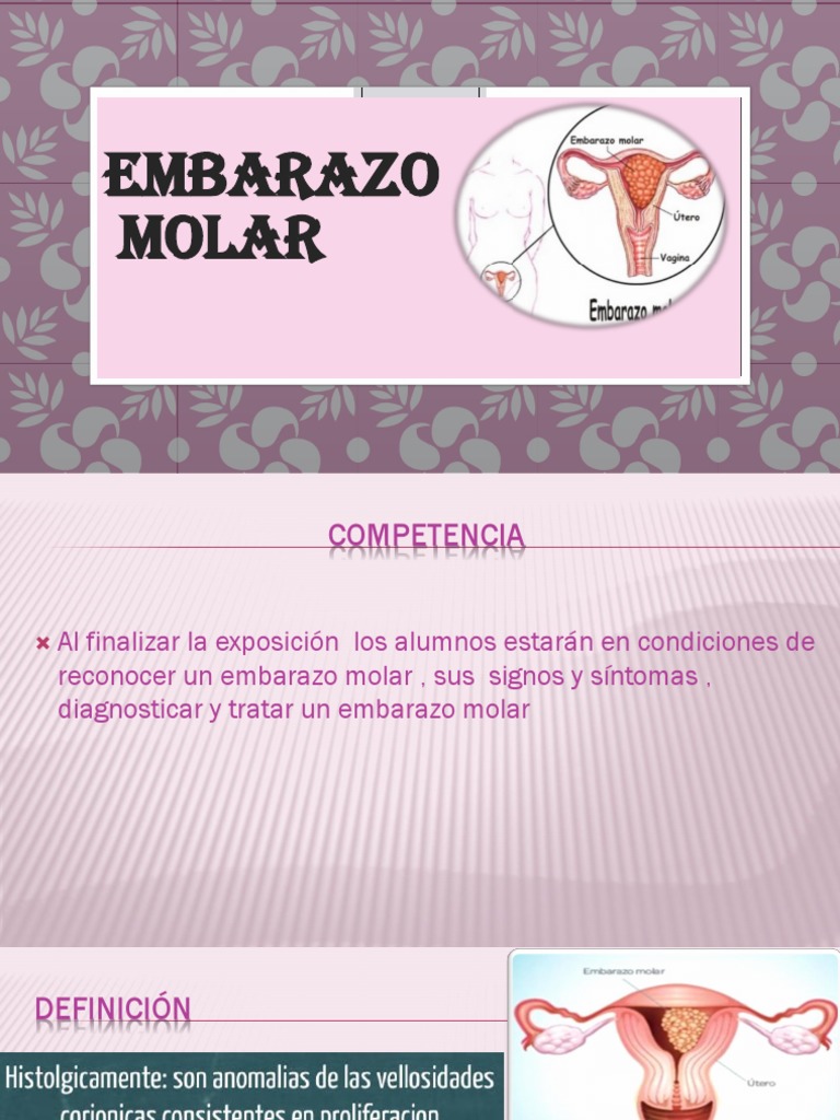 Embarazo Molar | PDF | La salud de la mujer | El embarazo