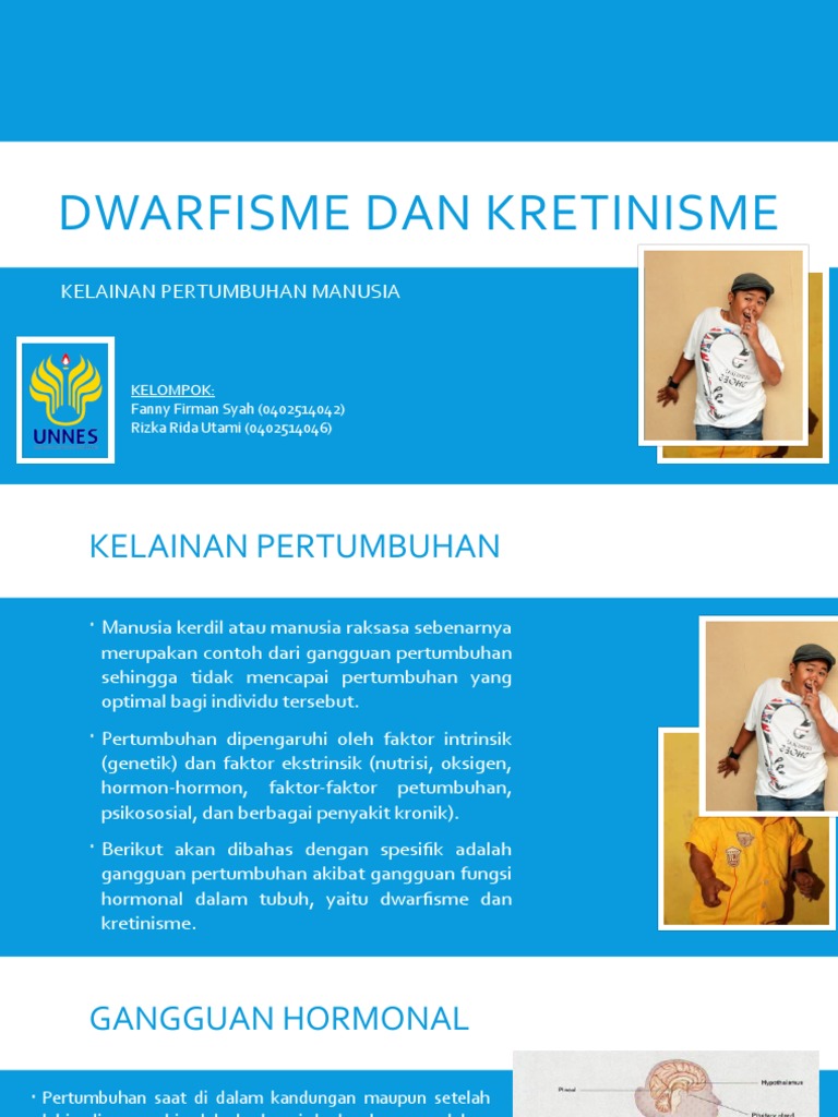 Dwarfisme Dan Kretinisme | PDF