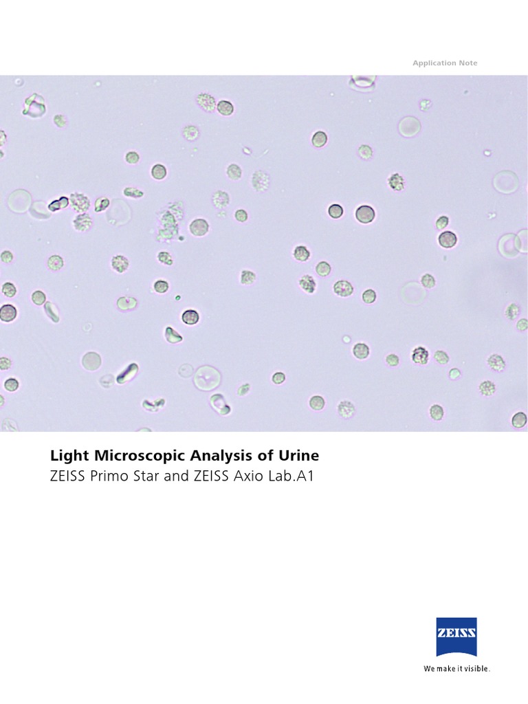 Lab Urine-Analysis | PDF | Urine | Microscopy
