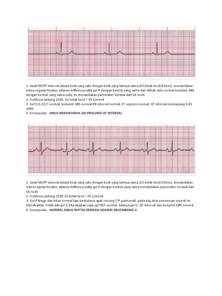 Soal Ekg 3 | PDF
