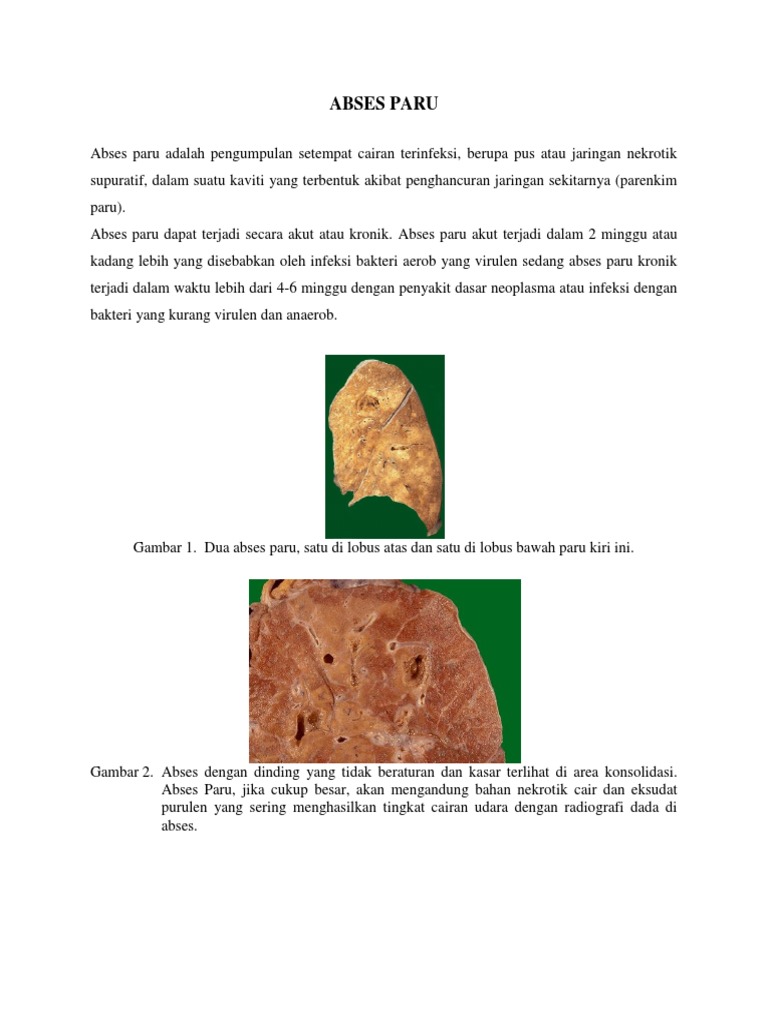 Abses Paru | PDF