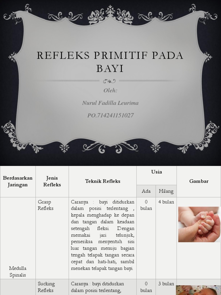 Refleks Primitif Pada Bayi Oleh Nurul Fadilla Leurima | PDF