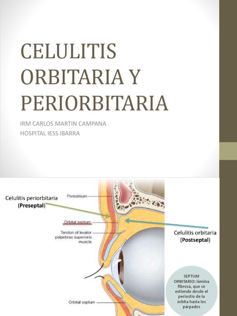 Celulitis Orbitaria y Periorbitaria | Salud pública | Epidemiología