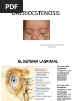 Fístula Preauricular: Características y Manejo | PDF | Inflamación | Pecho