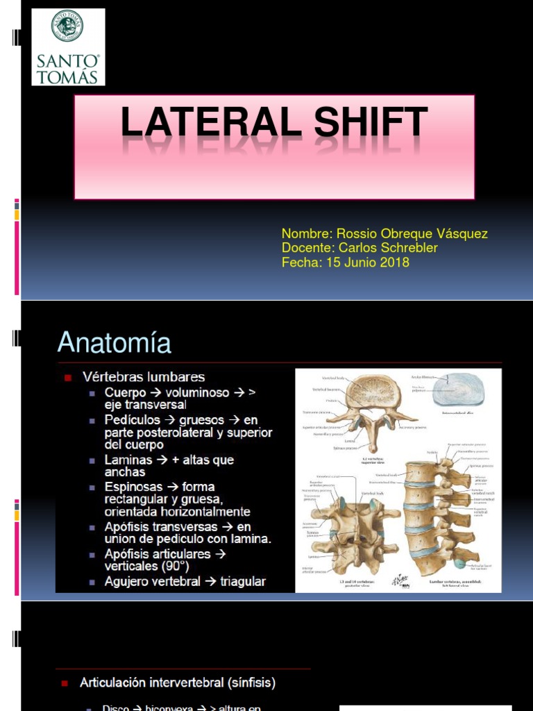 Lateral Shift | PDF | Vértebra | Sistema musculoesquelético