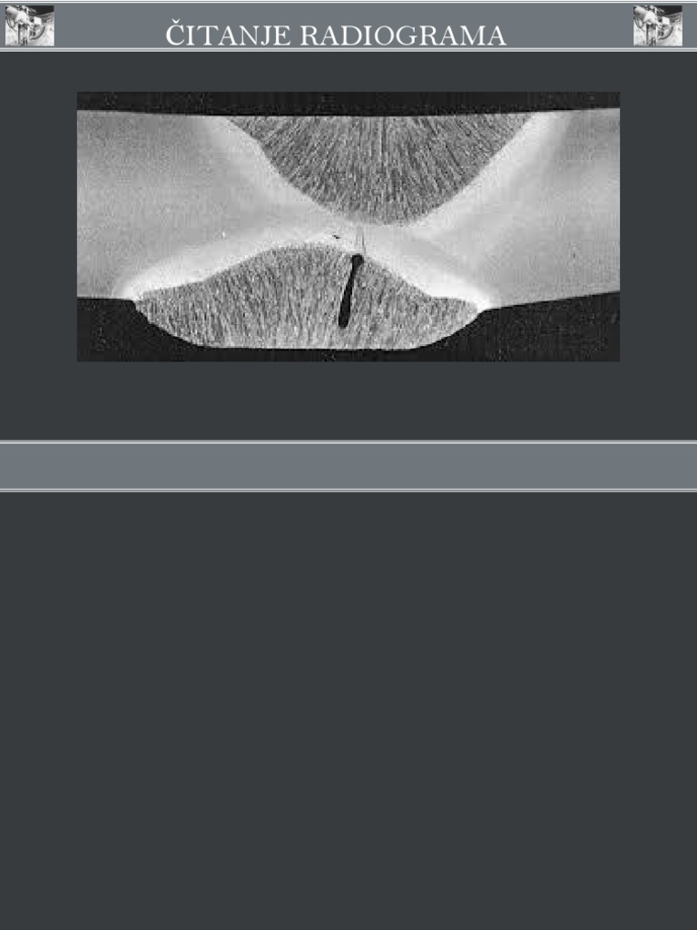How to Interpret X-Rays: A Guide to Reading Radiographic Images | PDF