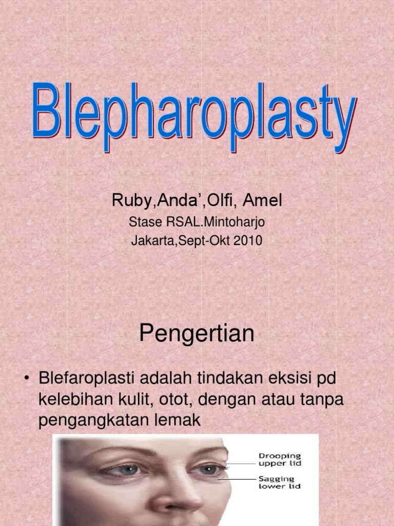 Blefaroplasti | PDF | Surgery | Ophthalmology