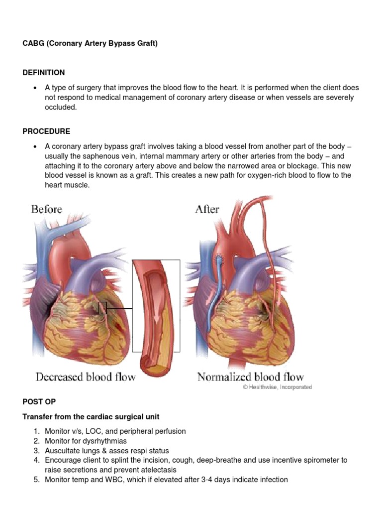 CABG Surgery Explained | PDF | Coronary Artery Bypass Surgery | Artery