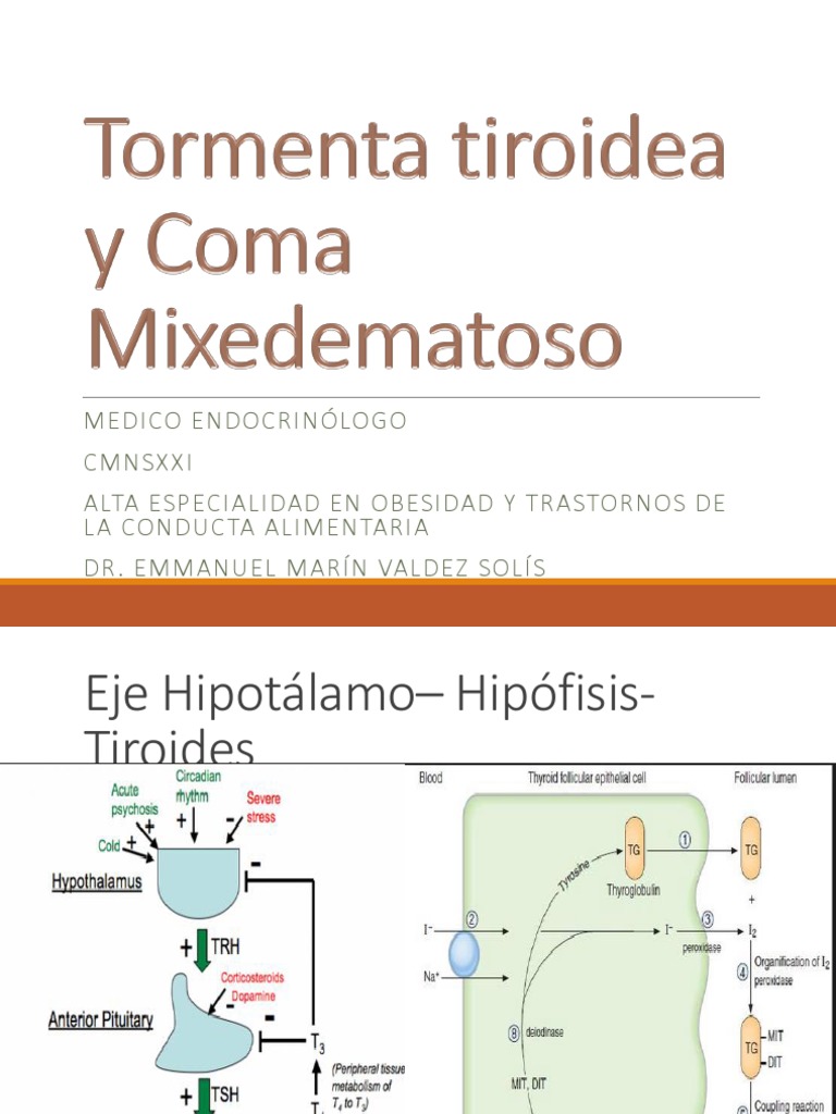Tormenta Tiroidea y Coma Mixedematoso | Hipertiroidismo | Sistema endocrino