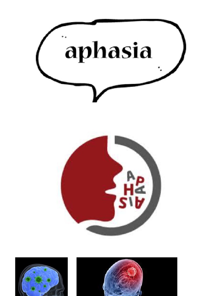 Aphasia | PDF | Speech | Aphasia