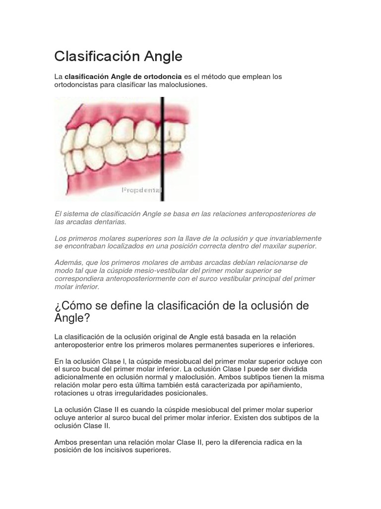 Clasificación Angle | Ortodoncia | Rasgos faciales