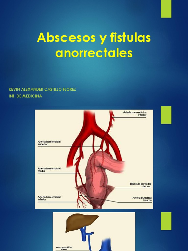 Abcesos y Fistulas Anorrectales | PDF | Recto | Medicina CLINICA