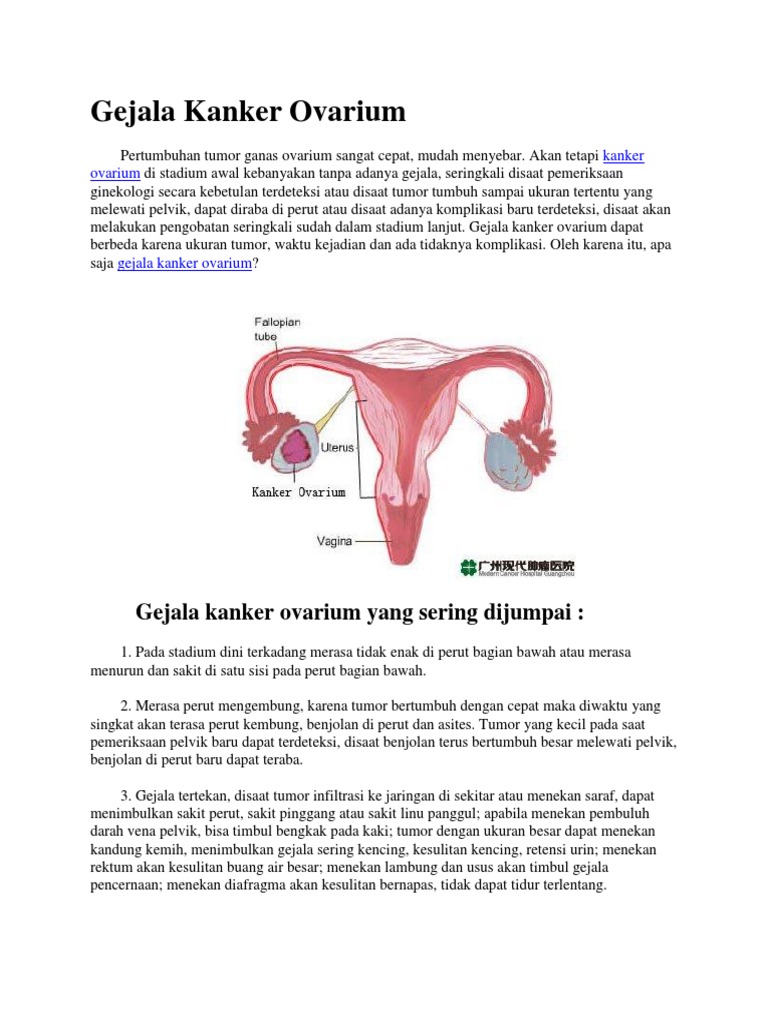 GEJALA KANKER OVARIUM | PDF