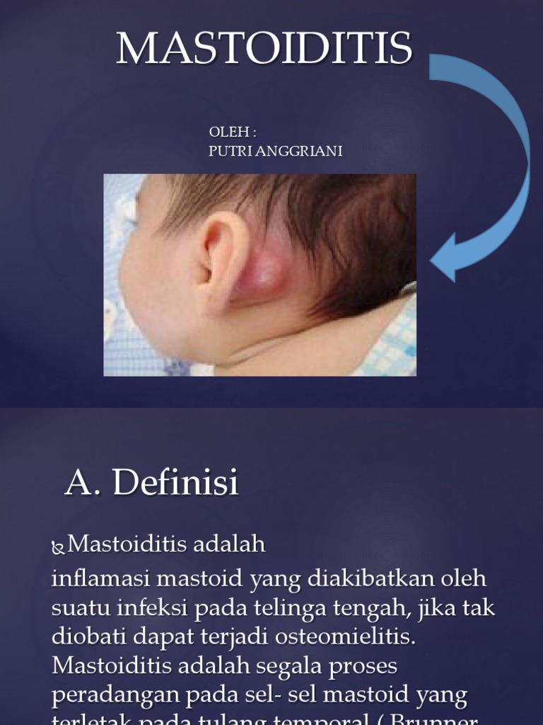 Penanganan Mastoiditis pada Anak | PDF