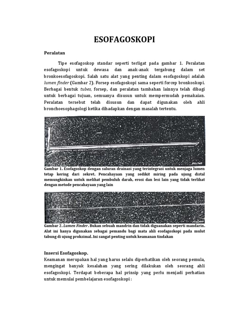 Esofagoskopi | PDF