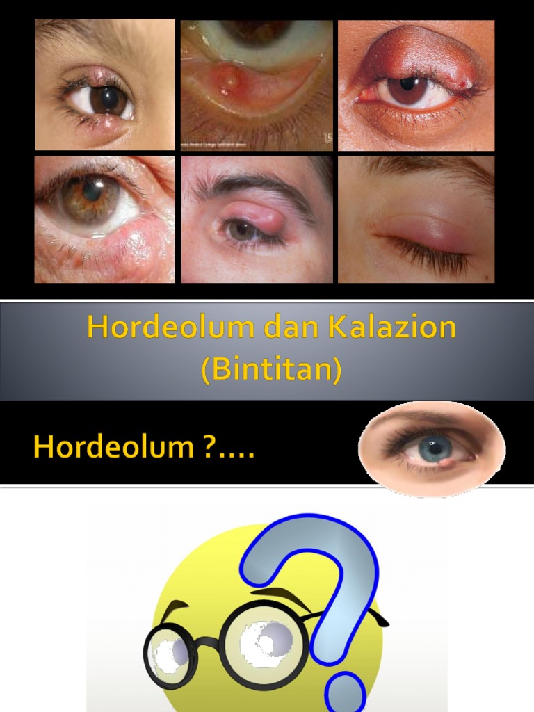 Hordeulum Dan Kalazion Pdf