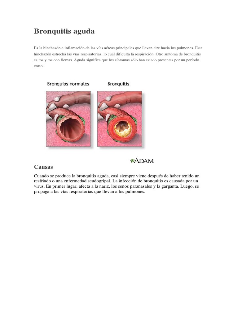 Bronquitis Aguda | PDF | Tos | Bronquitis