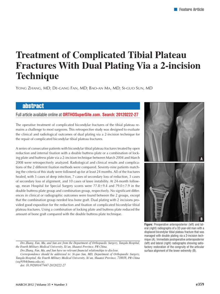 Treatment of Tibial Plateau Fractures Dual Plating Dual Incision | PDF ...