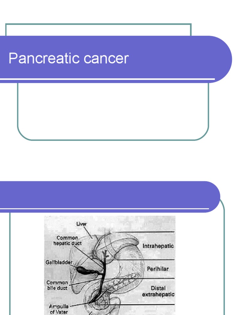 Comprehensive Overview of Pancreatic Cancer | PDF | Pancreatic Cancer ...
