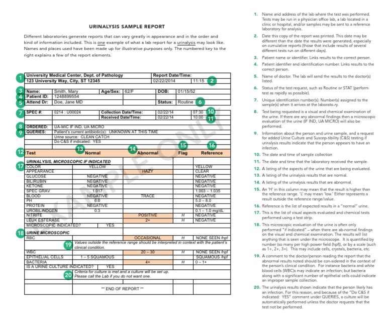 Urinalysis Sample Report With Notes - 0 | PDF | Urine | Health Sciences
