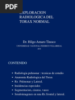 Radiografía de Tórax Normal - Patrón Intersticial | PDF | Pulmón | Tórax