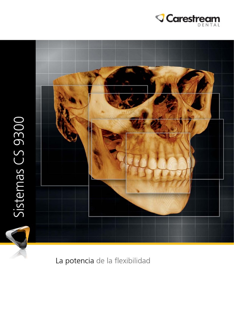 Catalogo Carestream CBCT MODELO 9300 PDF | PDF | Ct Scan | Software