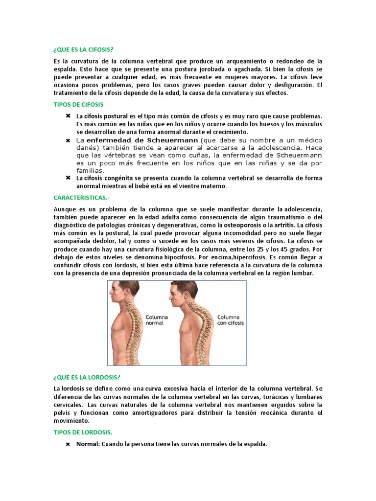 Que Es La Cifosis | PDF | La columna vertebral | Escoliosis