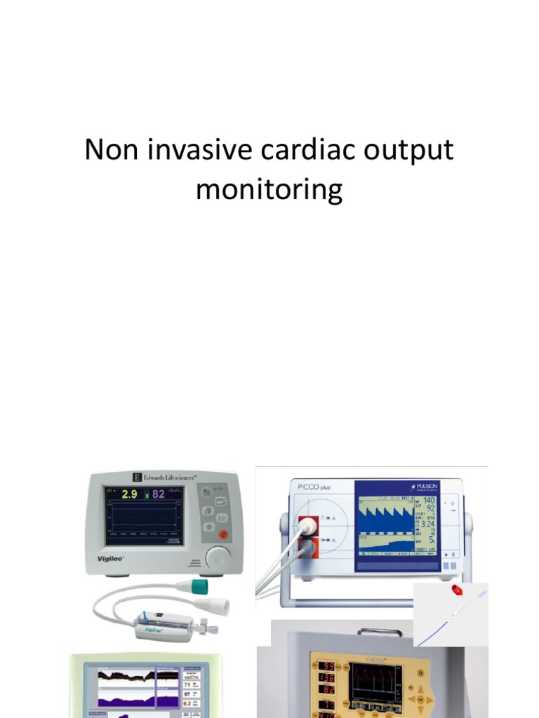 Non Invasive Cardiac Output Monitoring | PDF | Angiology | Medical ...