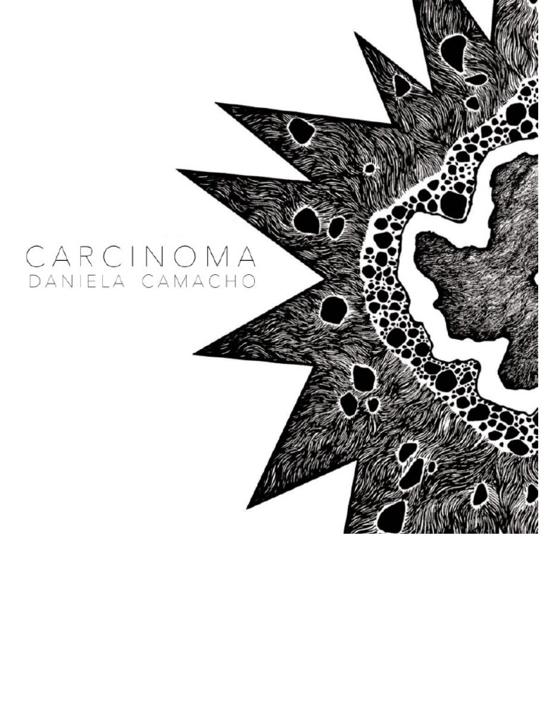 Daniela Camacho - Carcinoma | PDF | Metástasis | Cáncer