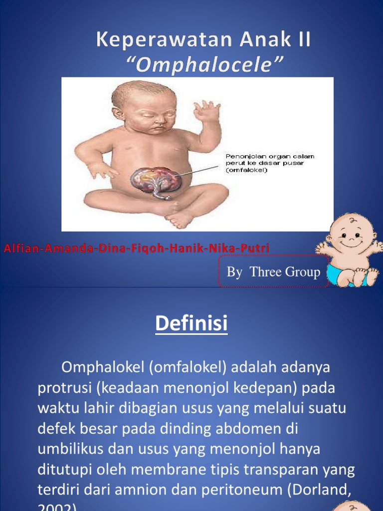 omphalocele