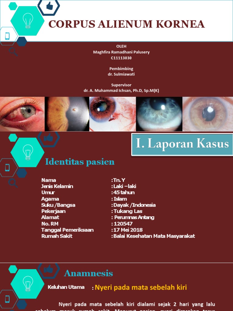 PPT-Corpus Alienum Kornea | PDF