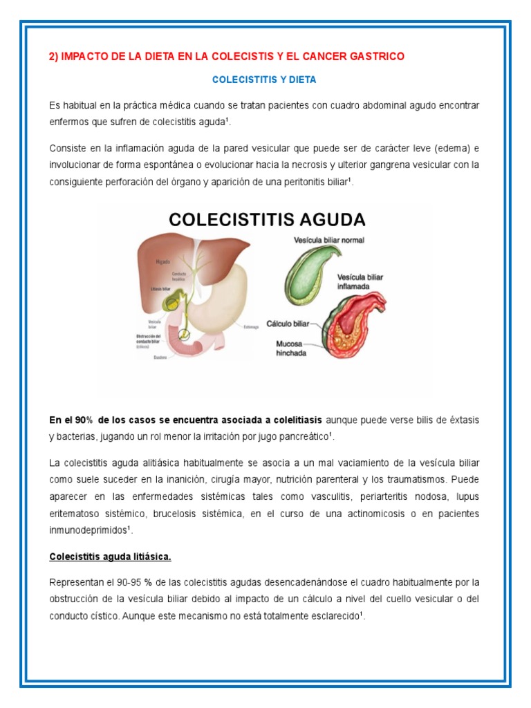 Impacto de La Dieta en Colecistitis y Cancer Gastrico | Colesterol | Bilis